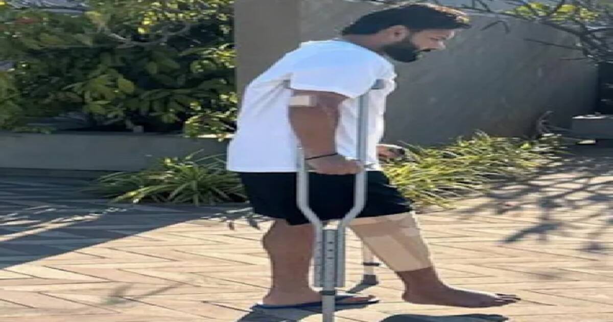 Recovery stage of Rishabh Pant after fatal Accident